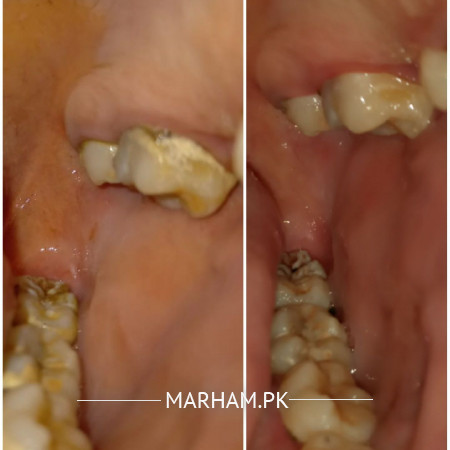 Dr. Aisha Rasool - Dentist | Marham
